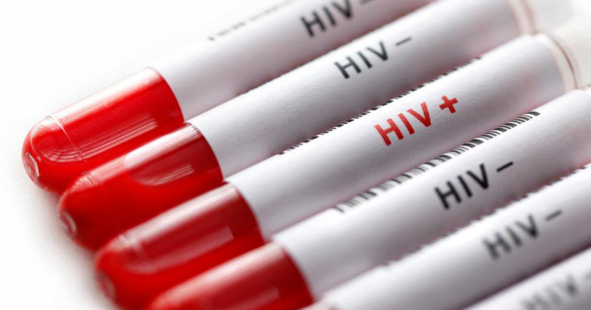 HIV/AIDS – Key Facts | Continuous Education Services (CES)